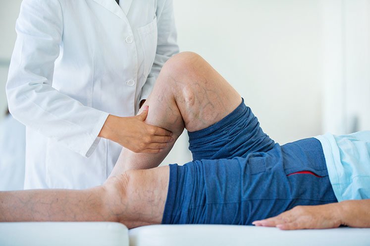 Deep Vein Thrombosis | Vein Center | Henry Ford Health - Detroit, MI