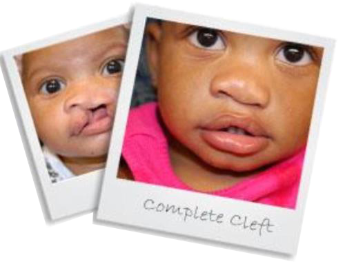 Photos | Cleft & Craniofacial Clinic | Henry Ford Health - Detroit, MI
