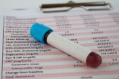 Improving Your Focus | Henry Ford Health - Detroit, MI